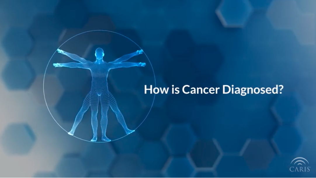 For Cancer Patients | Caris Life Sciences