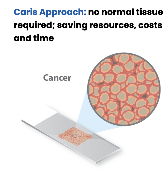 Microsatellite Instability (MSI) | Caris Life Sciences